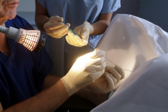 ŠTA SE DEŠAVA TOKOM EMBRIOTRANSFERA? I ŠTA RADITI POSLE? | ŠANSA ZA ...