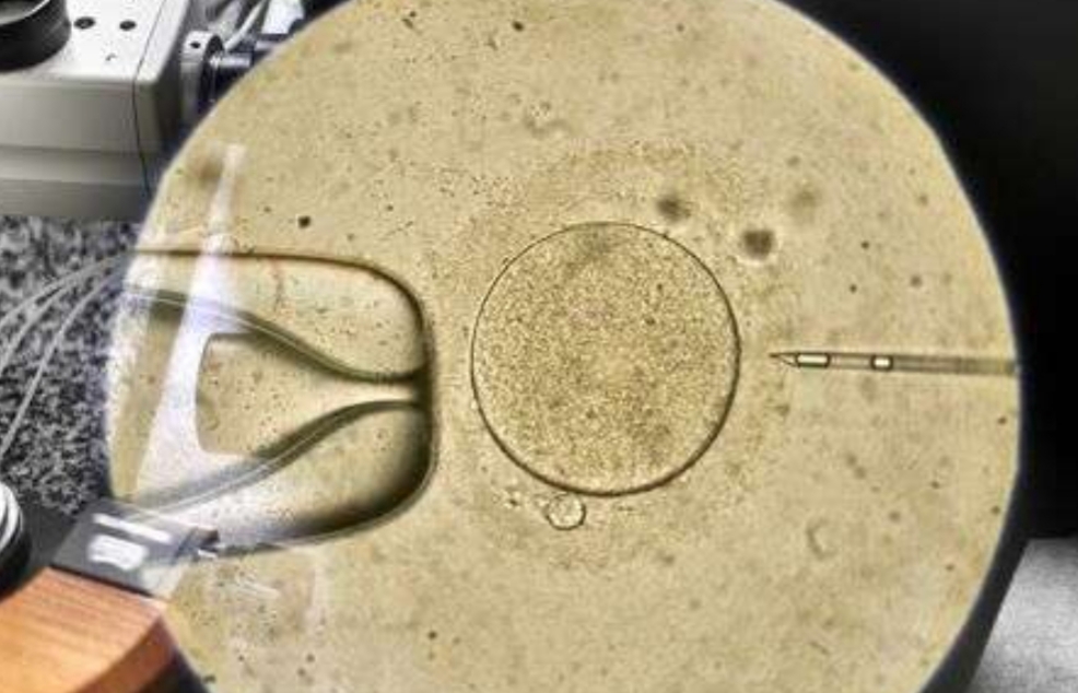 PRAVE ČINJENICE O DONACIJI JAJNIH ĆELIJA | ŠANSA ZA RODITELJSTVO