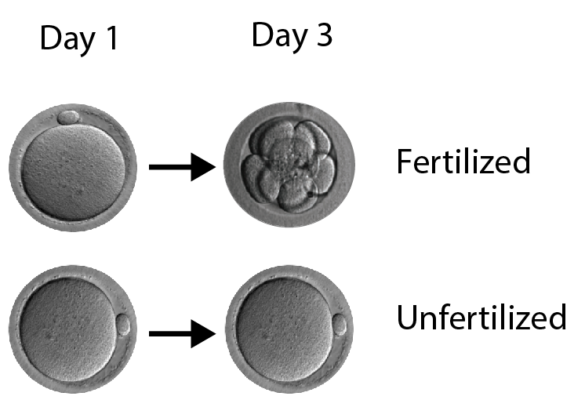 EMBRIOLOG OBJAŠNJAVA - KAKO IZGLEDA OPLODNJA JAJNE ĆELIJE ? | ŠANSA ZA ...